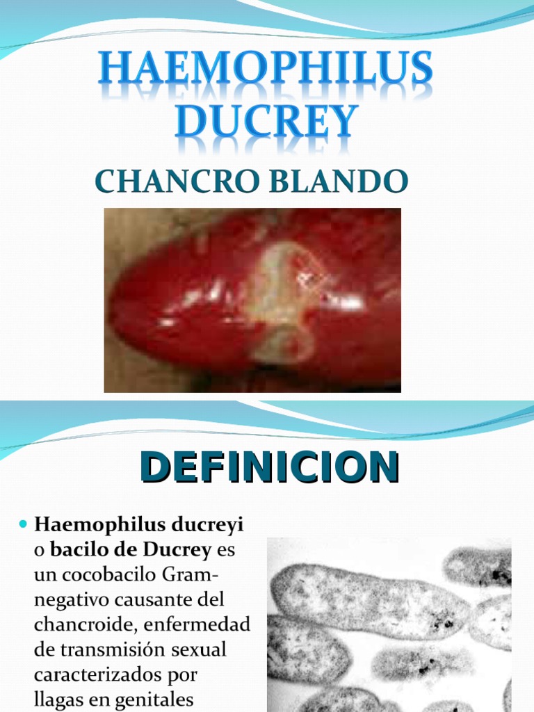 Chancro Blando: Definición y Tratamiento | PDF