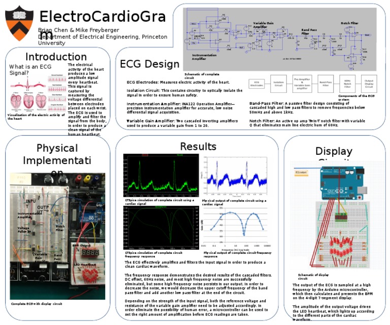 ECG Poster | PDF | Amplifier | Electrocardiography