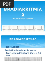 Índices Sokolow y Lewis en EKG | PDF