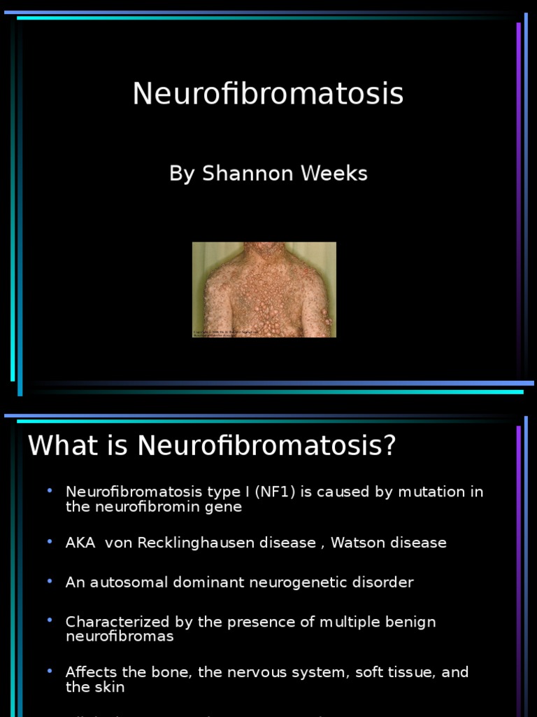 Neurofibromatosis | Biochemistry | Medical Specialties