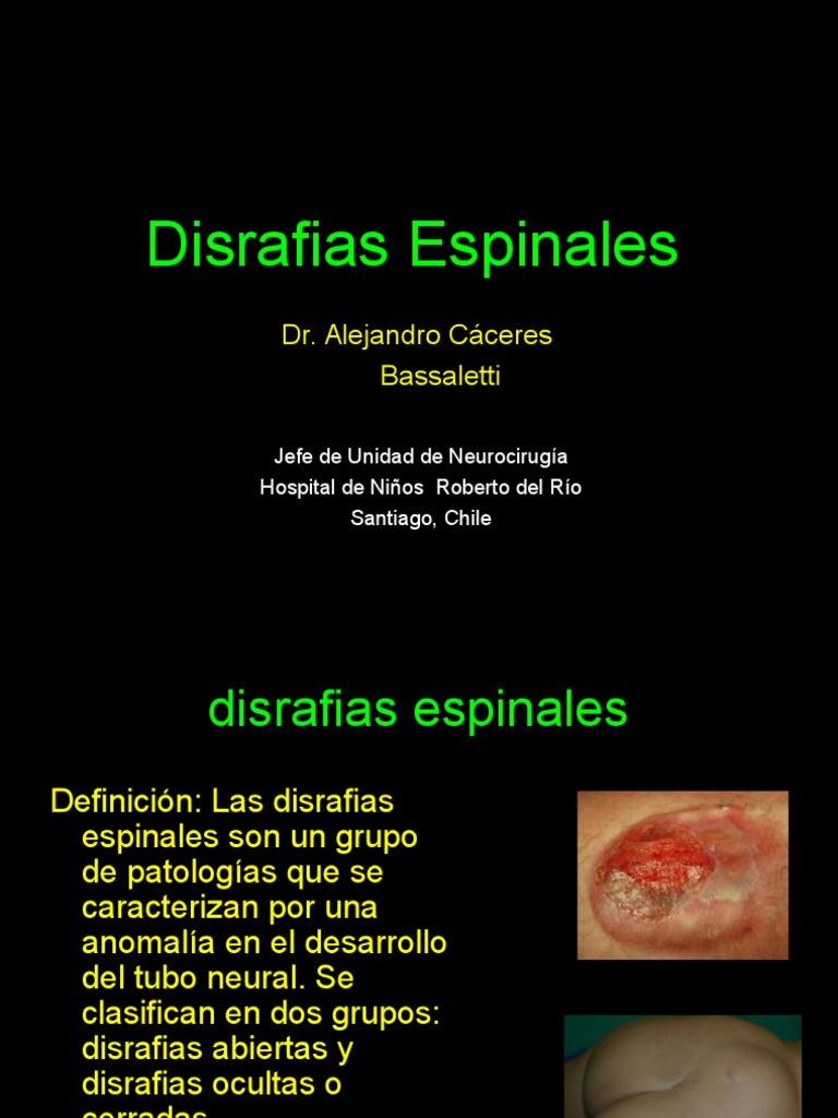 Disrafias Espinales: Tipos y Tratamientos | PDF | Medicina CLINICA ...