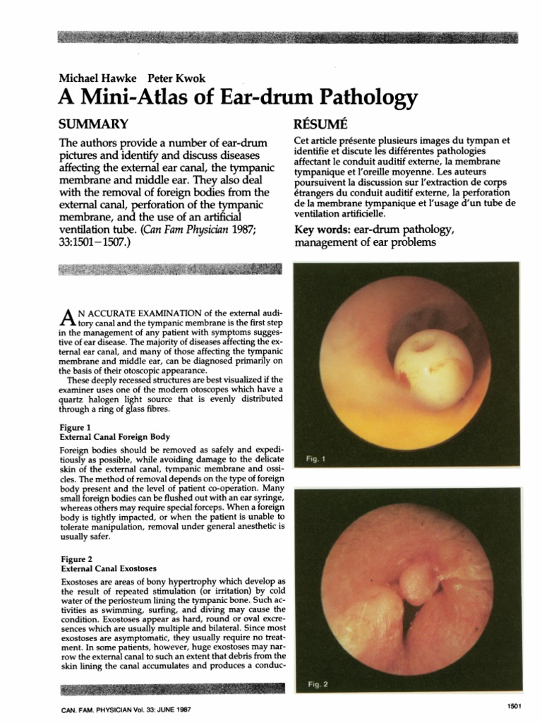 Mini-Atlas of Ear-Drum Pathology | PDF | Medicine | Auditory System