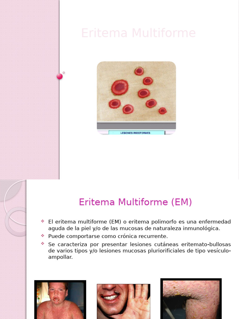Eritema Multiforme | PDF | Medicina CLINICA | Enfermedades y trastornos
