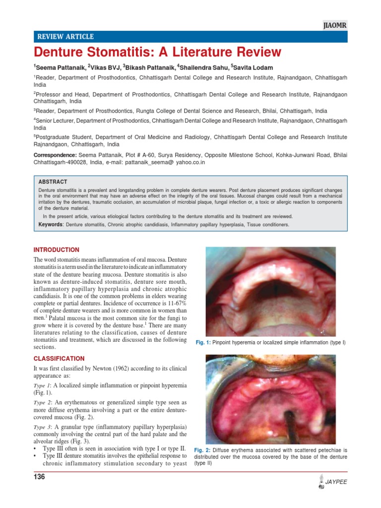 Denture Stomatitis | PDF | Candidiasis | Candida (Fungus)