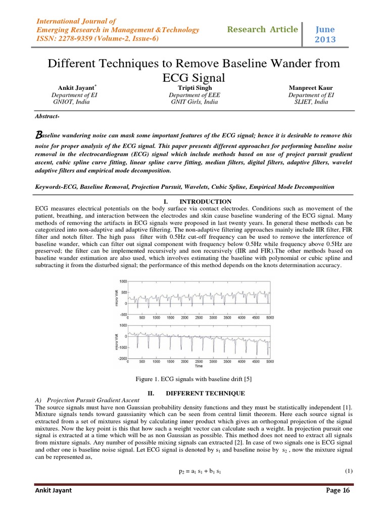 Pan Tompkins Algorithm | PDF | Electrocardiography | Wavelet