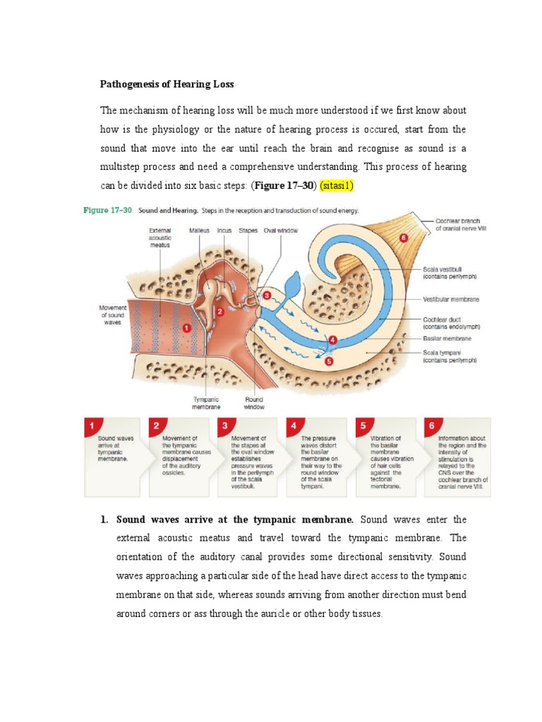 Pathogenesis of Hearing Loss | Ear | Hearing