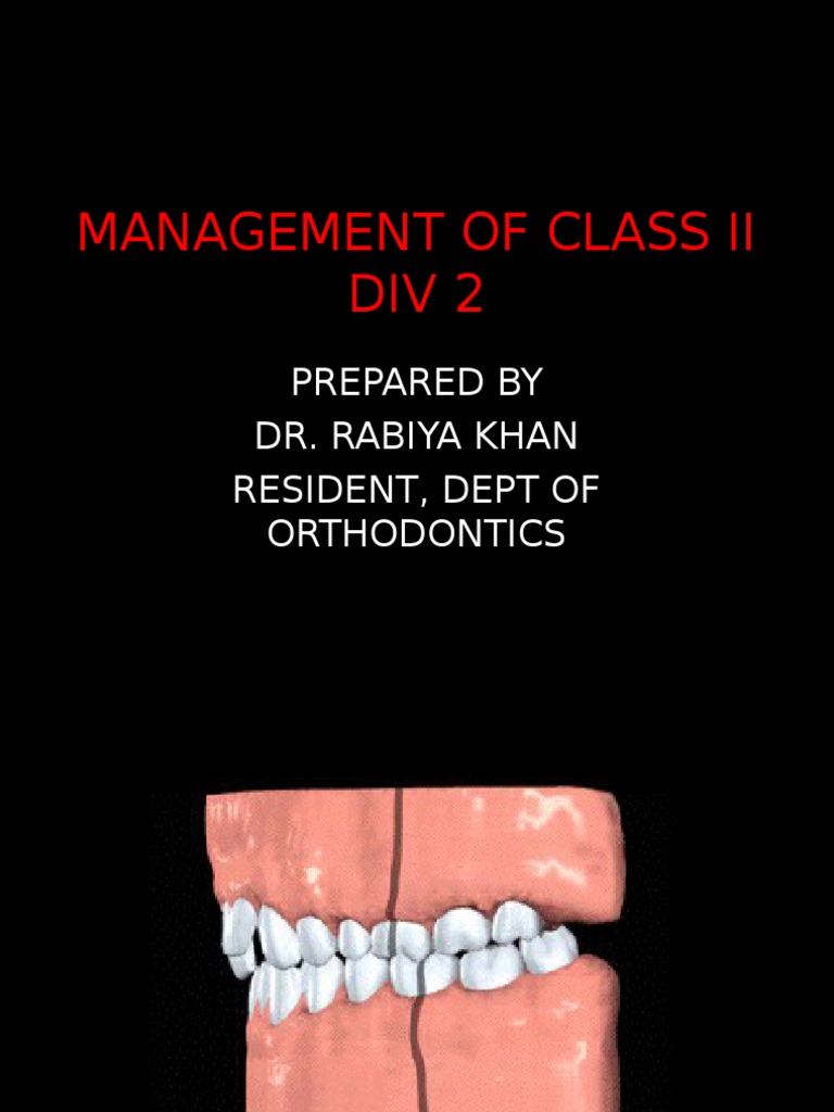 Management of Class Ii Div 2: Prepared by Dr. Rabiya Khan Resident ...