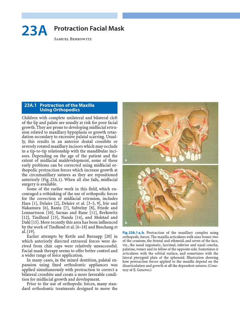 Maxillary Protraction in Cleft Patients | PDF | Dentistry Branches ...