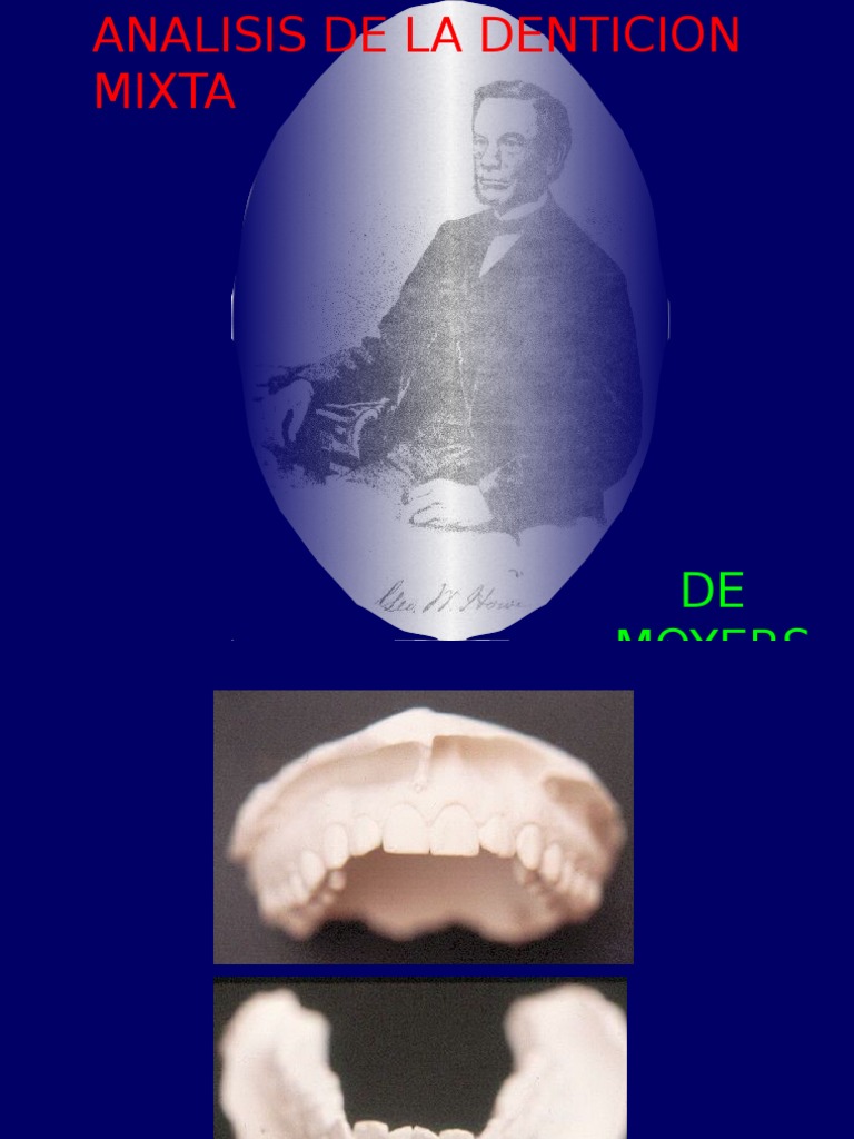 Analisis de Modelos de Moyers 1201121187716047 4 | PDF