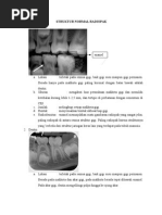 Interpretasi Hasil Foto Rontgen Anatomi Normal | PDF