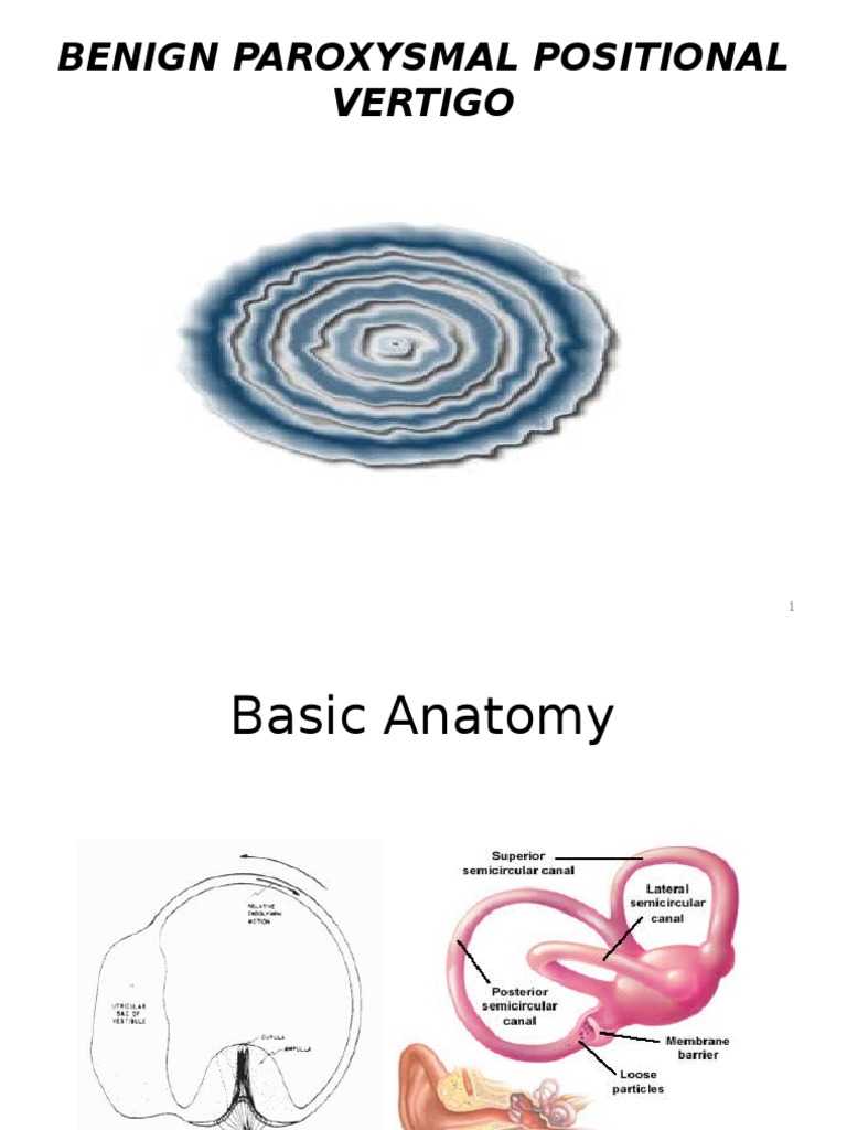 BPPV | PDF | Vertigo | Neurological Disorders