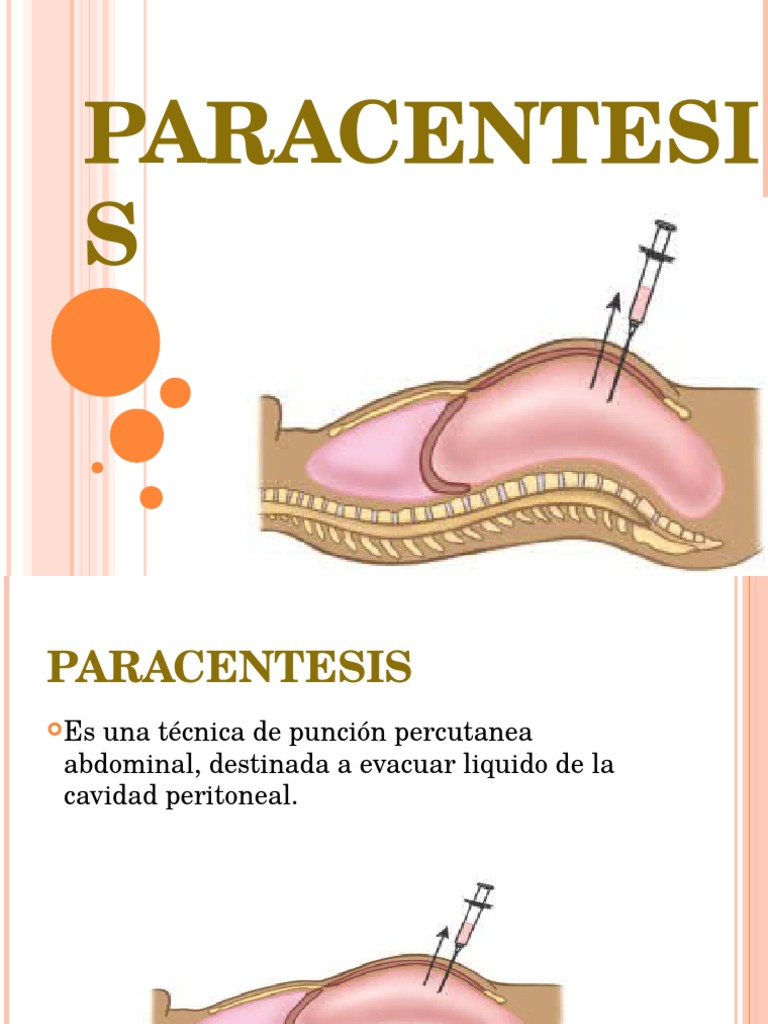 Técnica de Paracentesis Abdominal | PDF | Especialidades Medicas ...