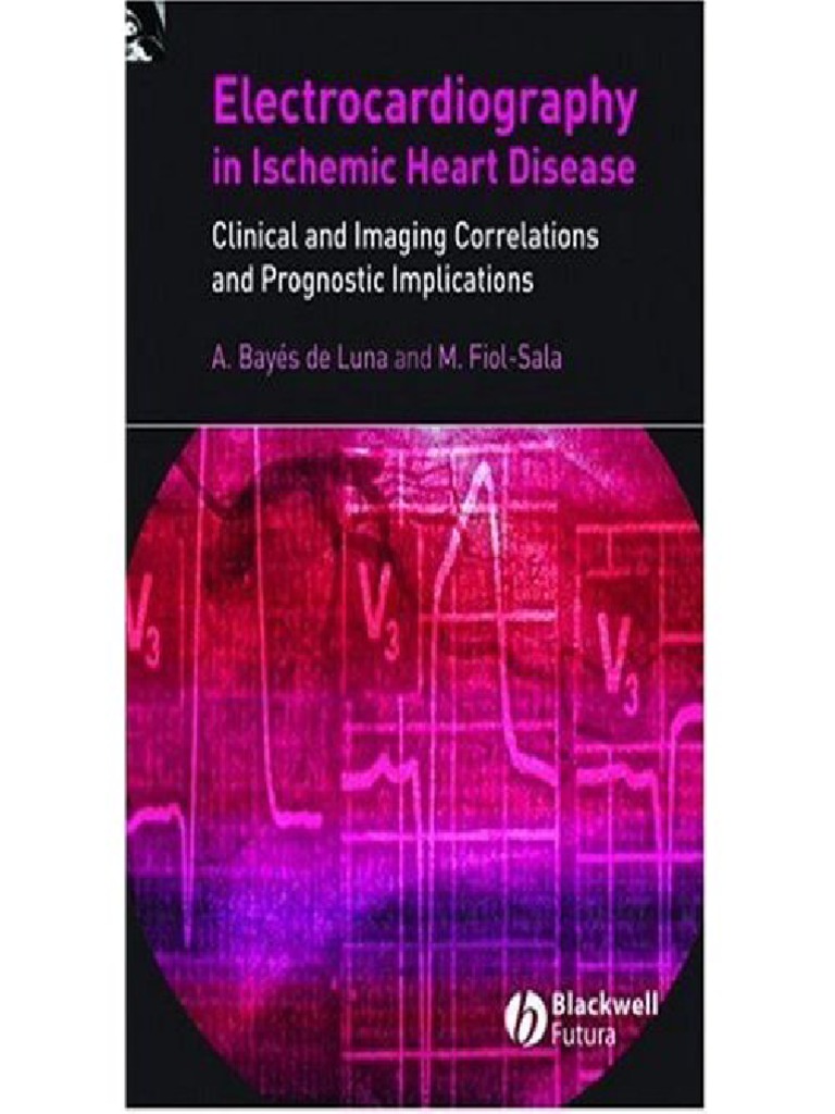 EKG in IHD | PDF | Electrocardiography | Coronary Artery Disease
