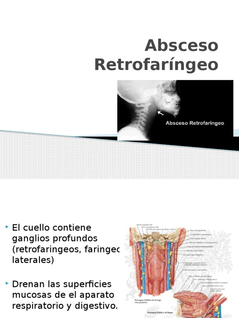 Absceso Retrofaríngeo | PDF | Sistema linfático | Ct Scan