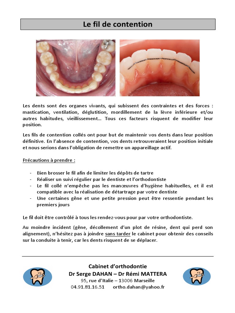 Fil de Contention | PDF