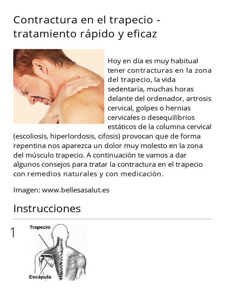 Contractura en El Trapecio - Tratamiento Rápido y Eficaz | PDF ...