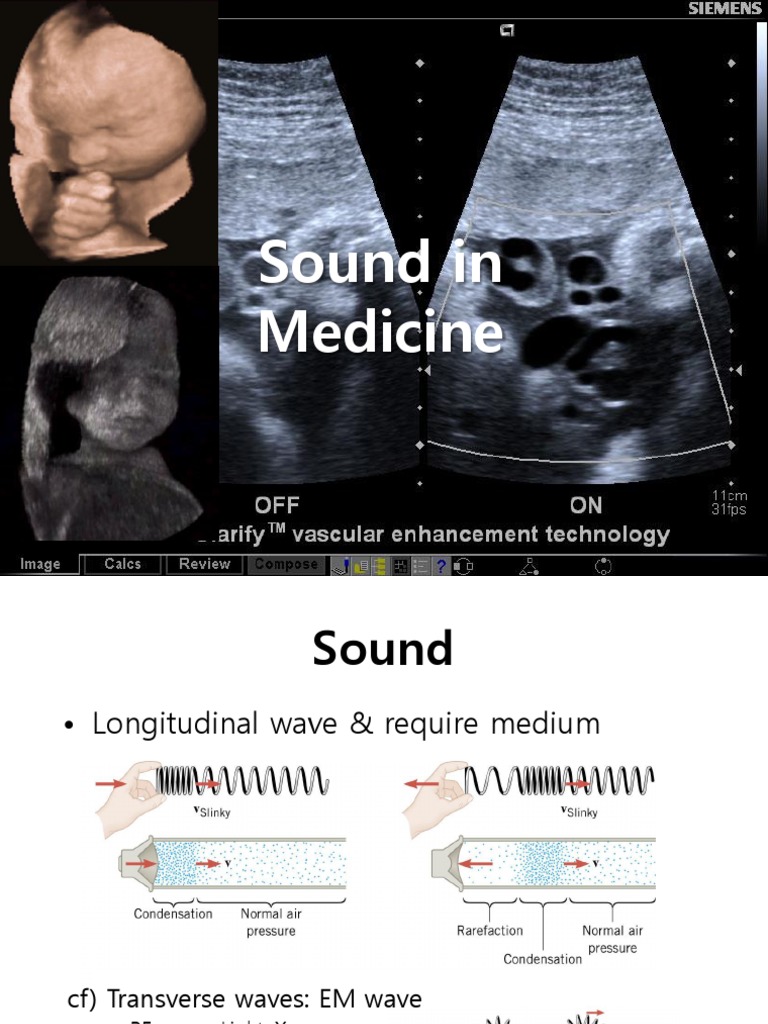 1__2__ | Medical Ultrasound | Attenuation