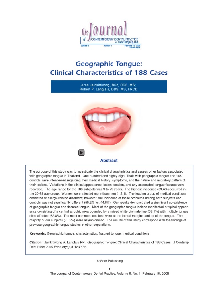 Geographic Tongue: Clinical Characteristics of 188 Cases | PDF