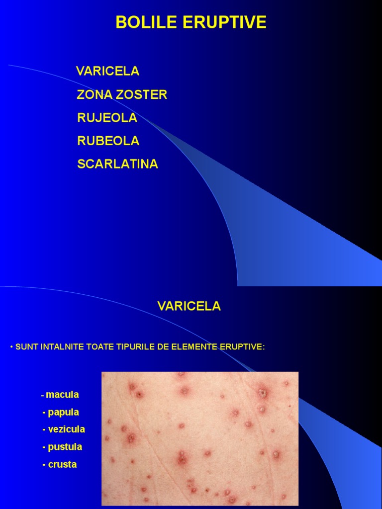 Erupții cutanate: Varicela și Rujeola | PDF
