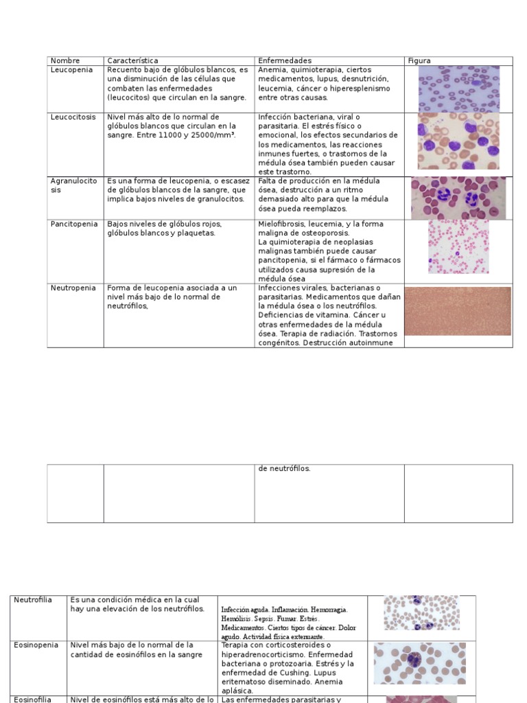 Globulos Blancos Anormales | PDF | Leucocito | Leucemia