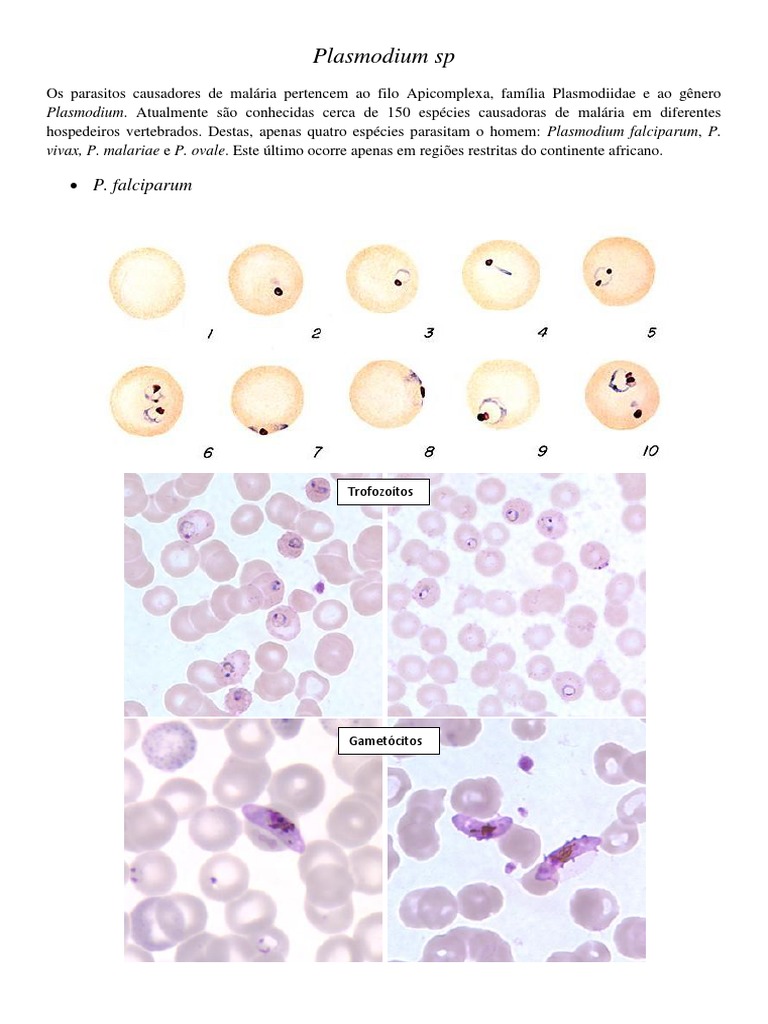 Plasmodium SP | PDF