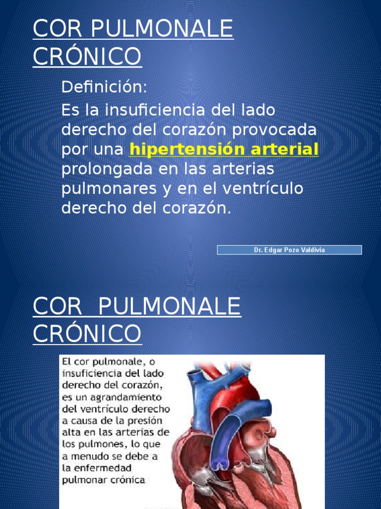 Cor Pulmonale Crónico | PDF | Pulmón | Sistema cardiovascular