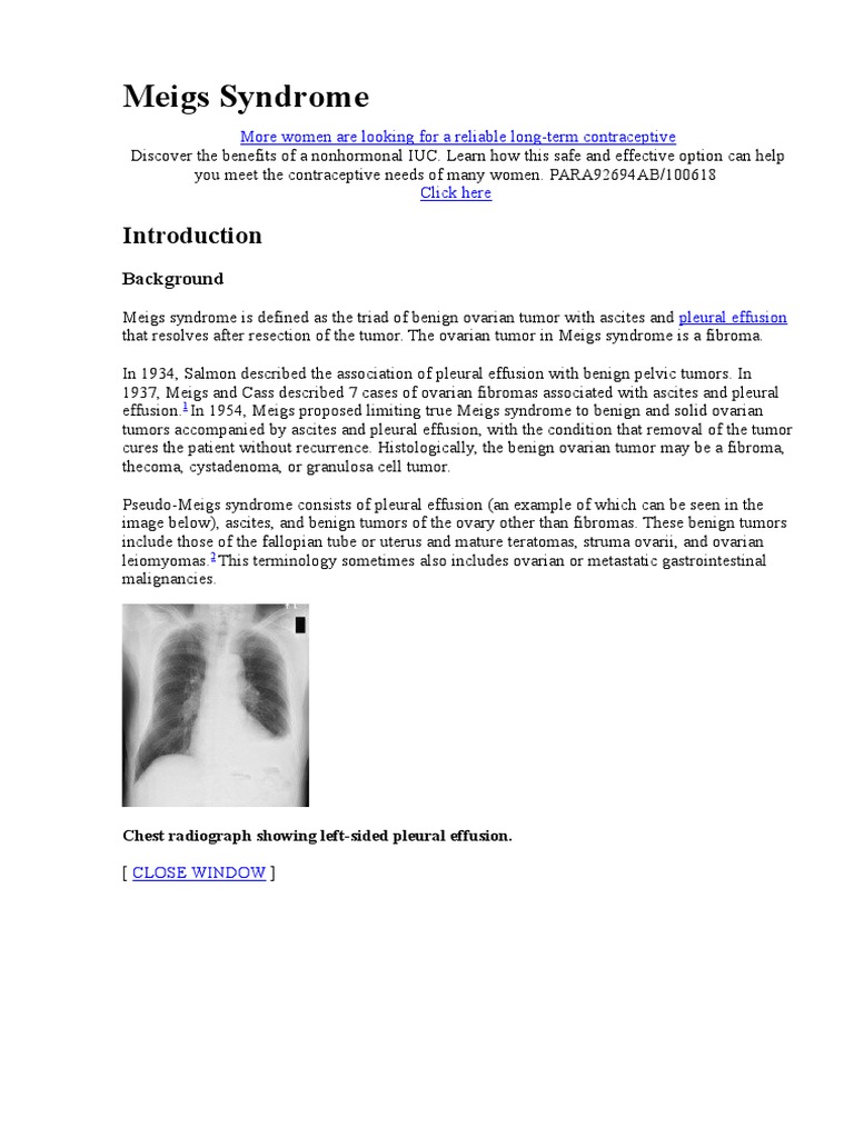 Meigs Syndrome: Pleural Effusion and Ascites from Benign Ovarian Tumor ...