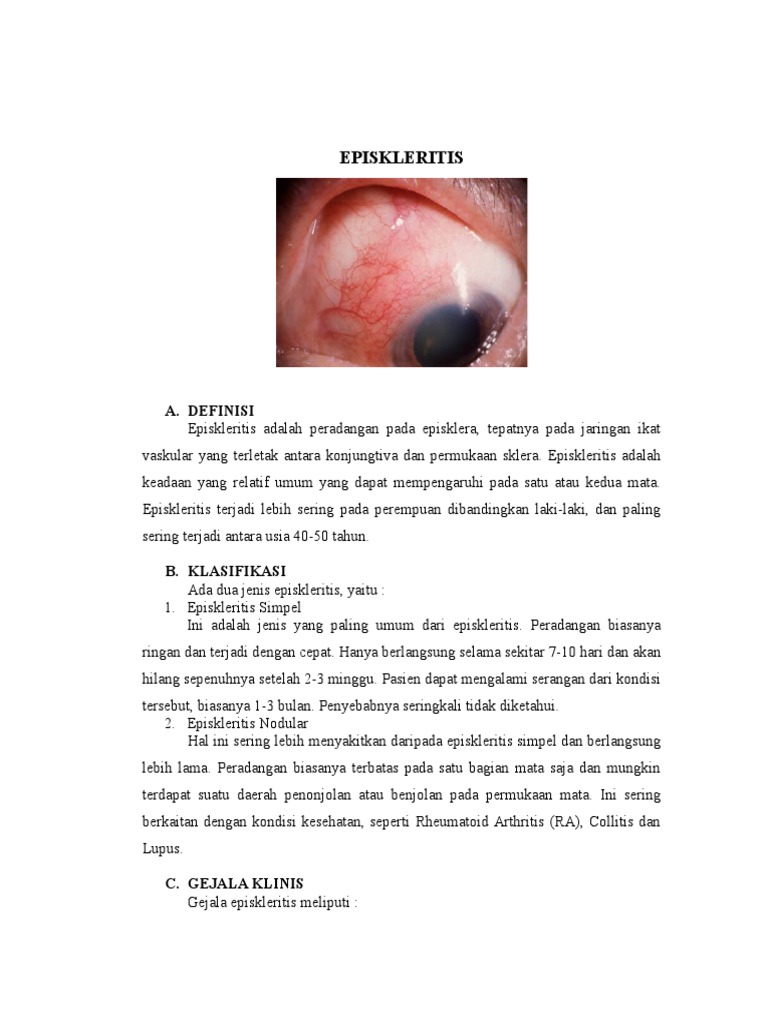 EPISKLERITIS | PDF