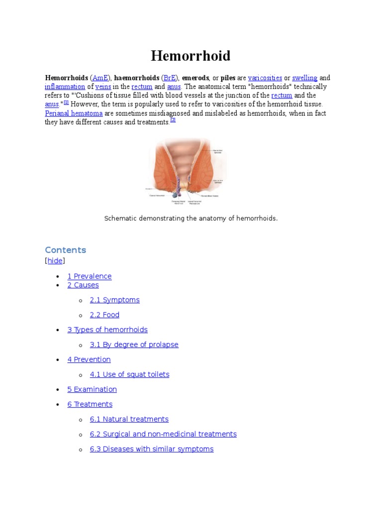 Hemorrhoid: Hemorrhoids ( | PDF | Hemorrhoid | Thrombosis