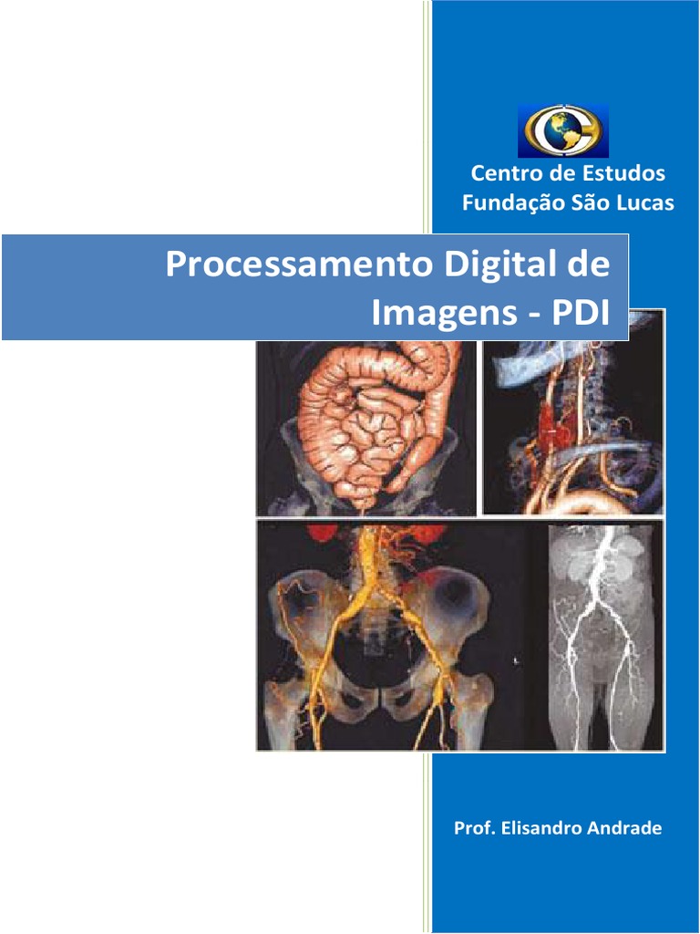 Processamento Digital de Imagens | PDF | Pixel | Histograma