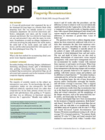 EMRA SportsMedicine Splint Guide | PDF | Thumb | Hand