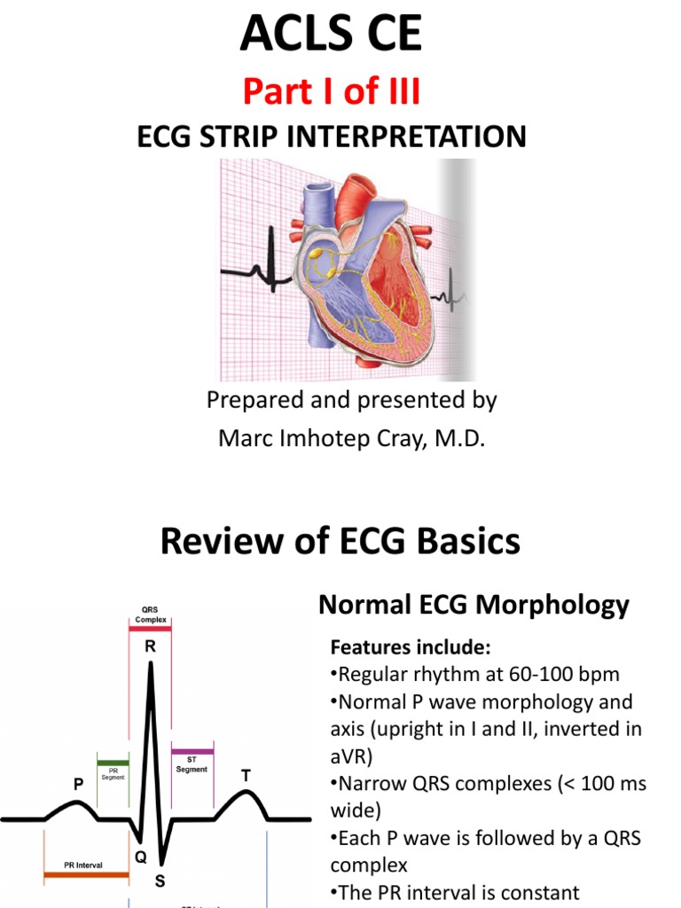 ACLS CE-Part I of III -ECG Strip Interpretation w Case Scenarios ...