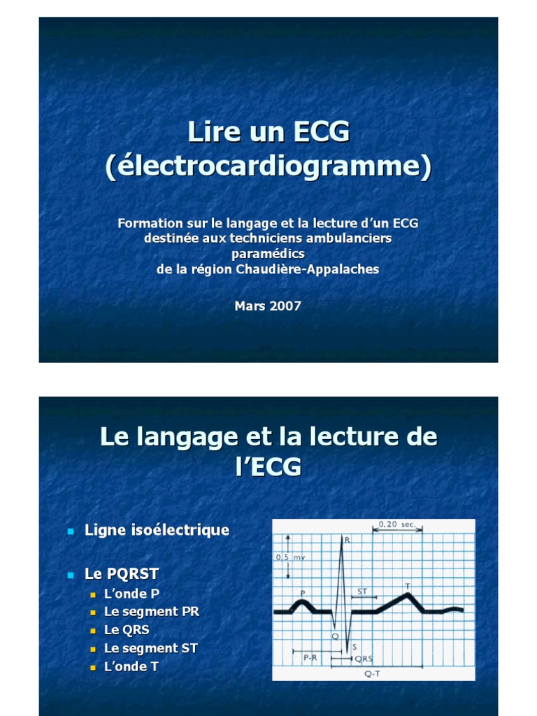 Lire Un ECG | Électrocardiographie | Cœur