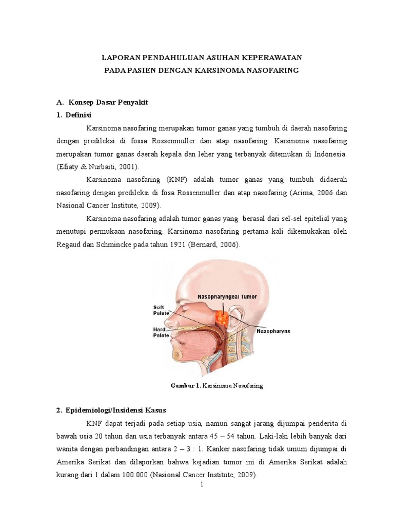 LP CA Nasofaring | PDF