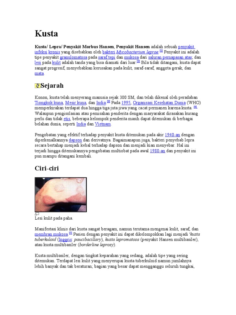 Kusta/ Lepra/ Penyakit Morbus Hansen, Penyakit Hansen