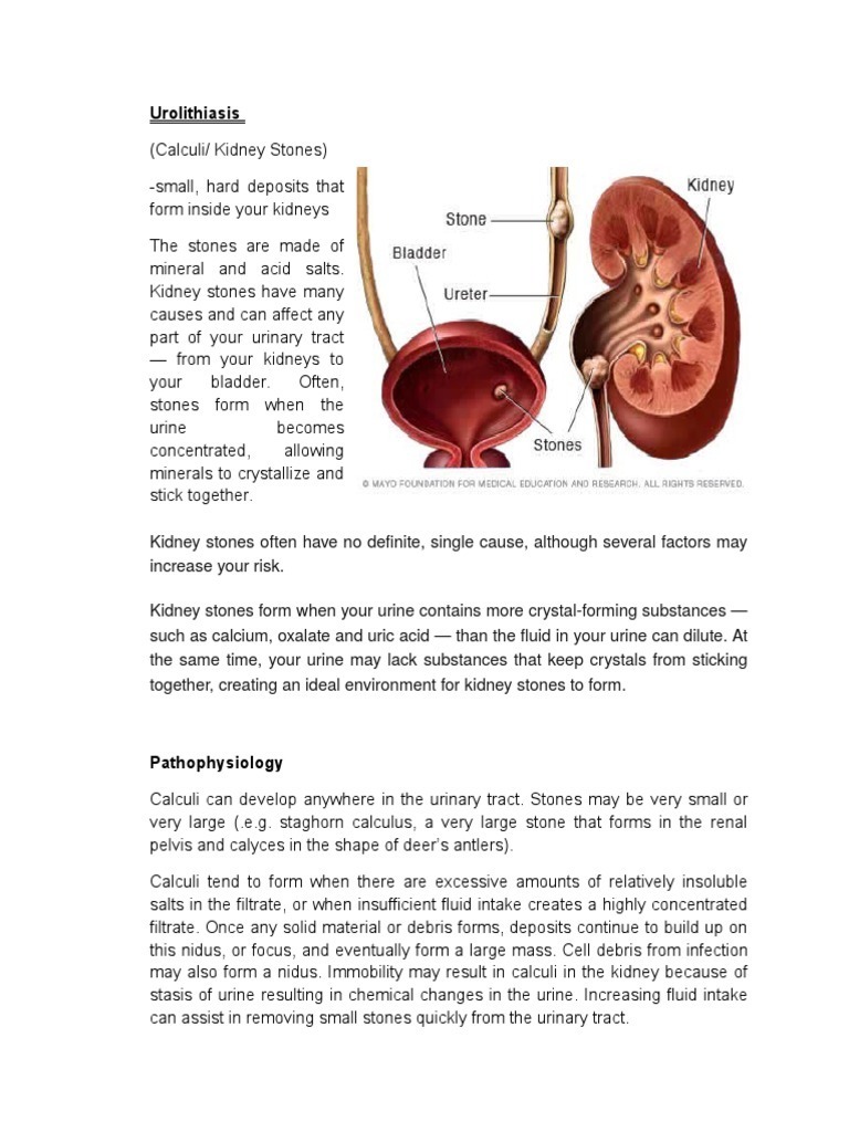 Urolithiasis | Download Free PDF | Kidney | Diseases And Disorders