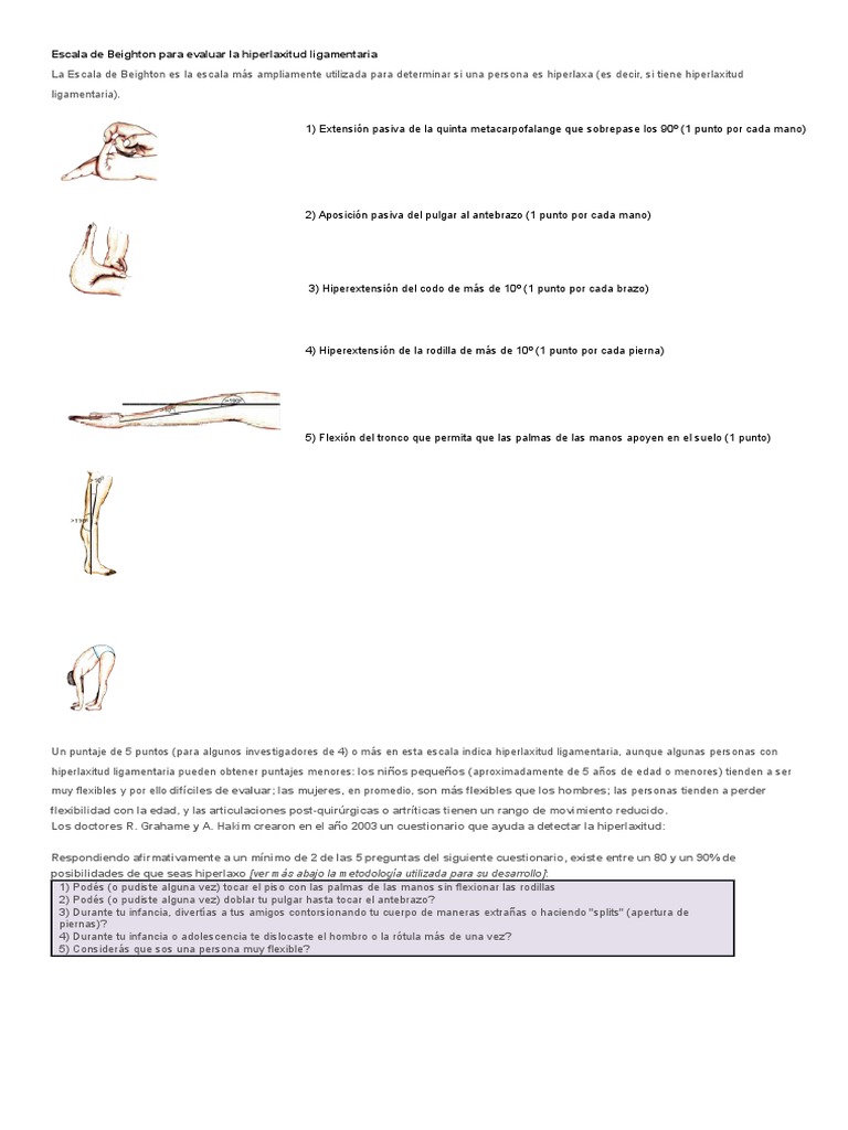 Escala de Beighton para Evaluar La Hiperlaxitud Ligamentaria | PDF ...