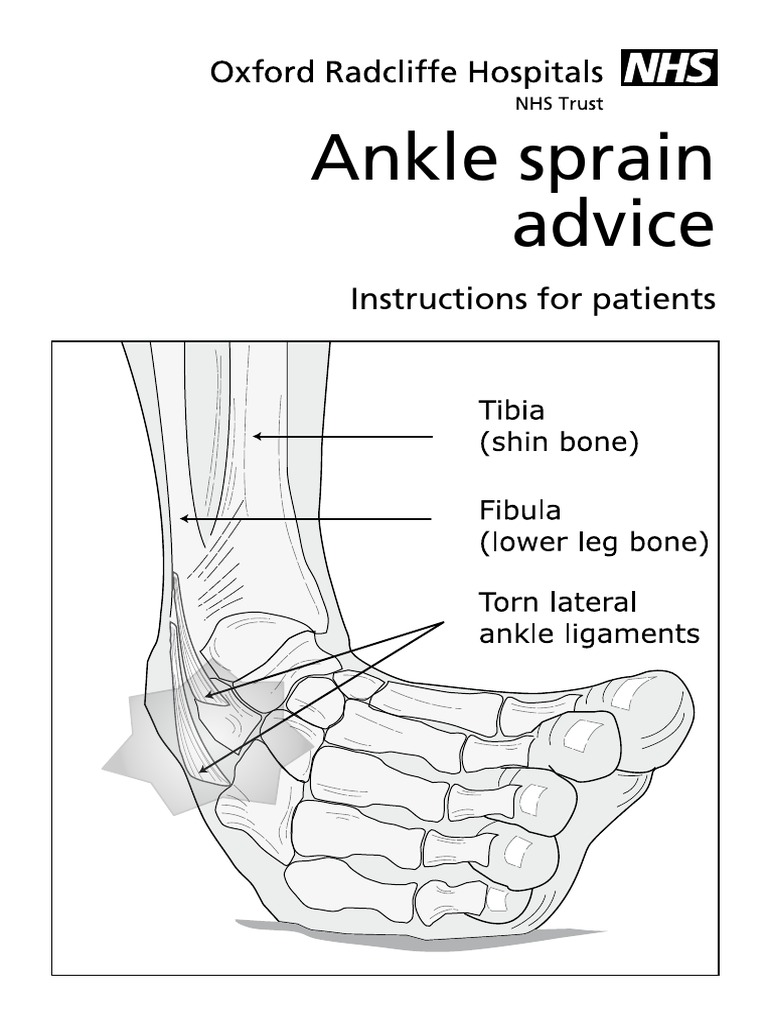 Ankle Sprain Advice: Instructions For Patients | PDF | Ankle | Clinical ...