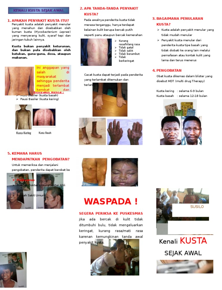 Leaflet Kusta Sejak Awal | PDF