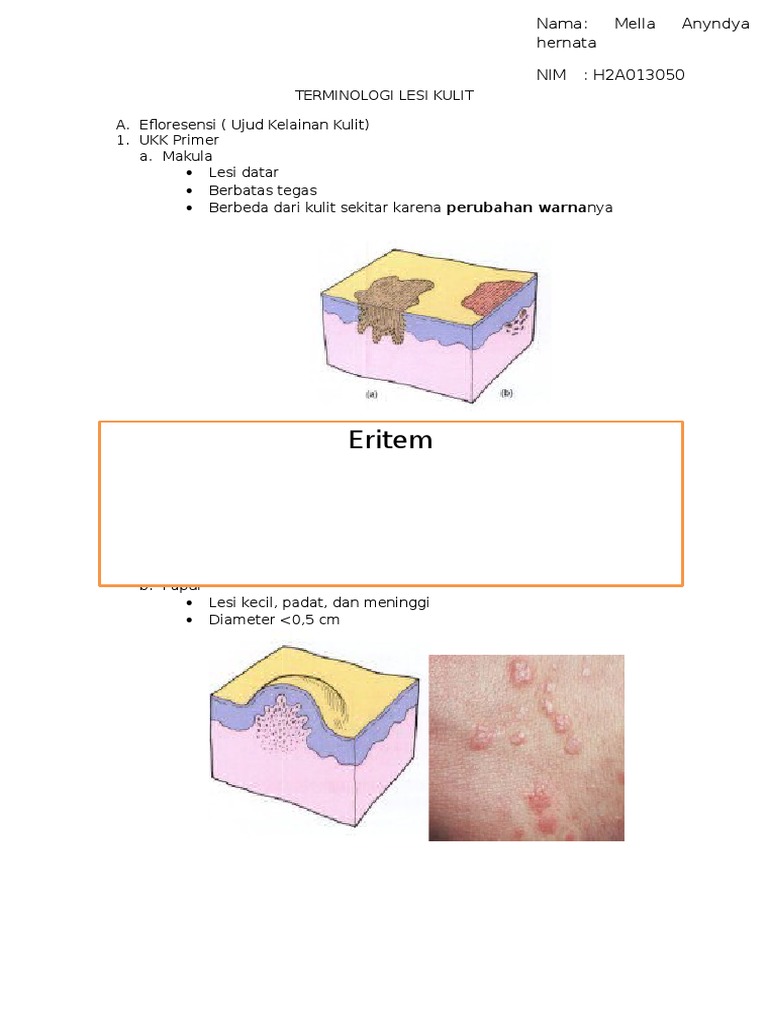 Terminologi Lesi Kulit Tugas Skill Lab | PDF