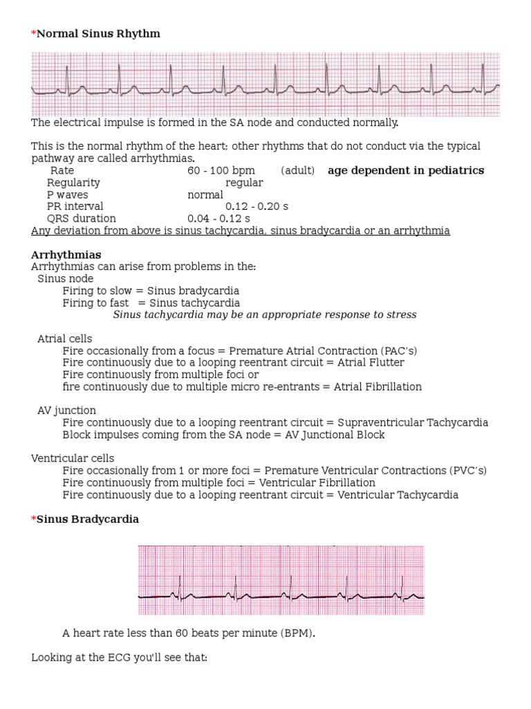Rhythm | PDF | Cardiac Arrhythmia | Electrocardiography
