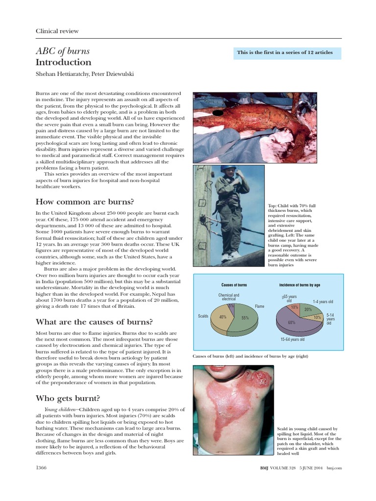 ABC of burns 1 | Burn | Emergency Department