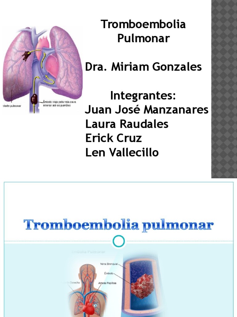 Tromboembolia Pulmonar | PDF | Especialidades Medicas | Medicina CLINICA