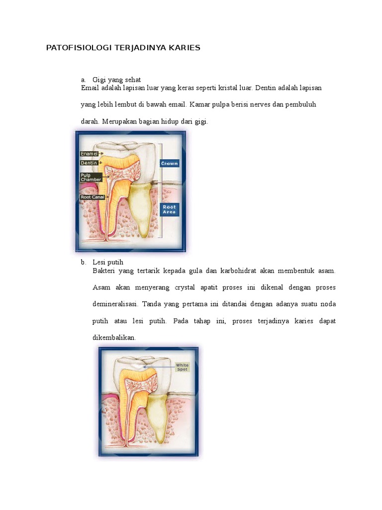 Proses Terbentuknya Karies Gigi | PDF | Griya & Taman | Sains & Matematika