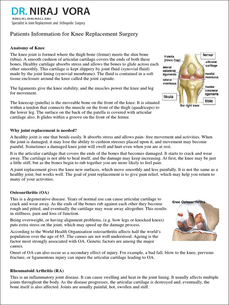 Knee Replacement | PDF | Knee | Osteoarthritis