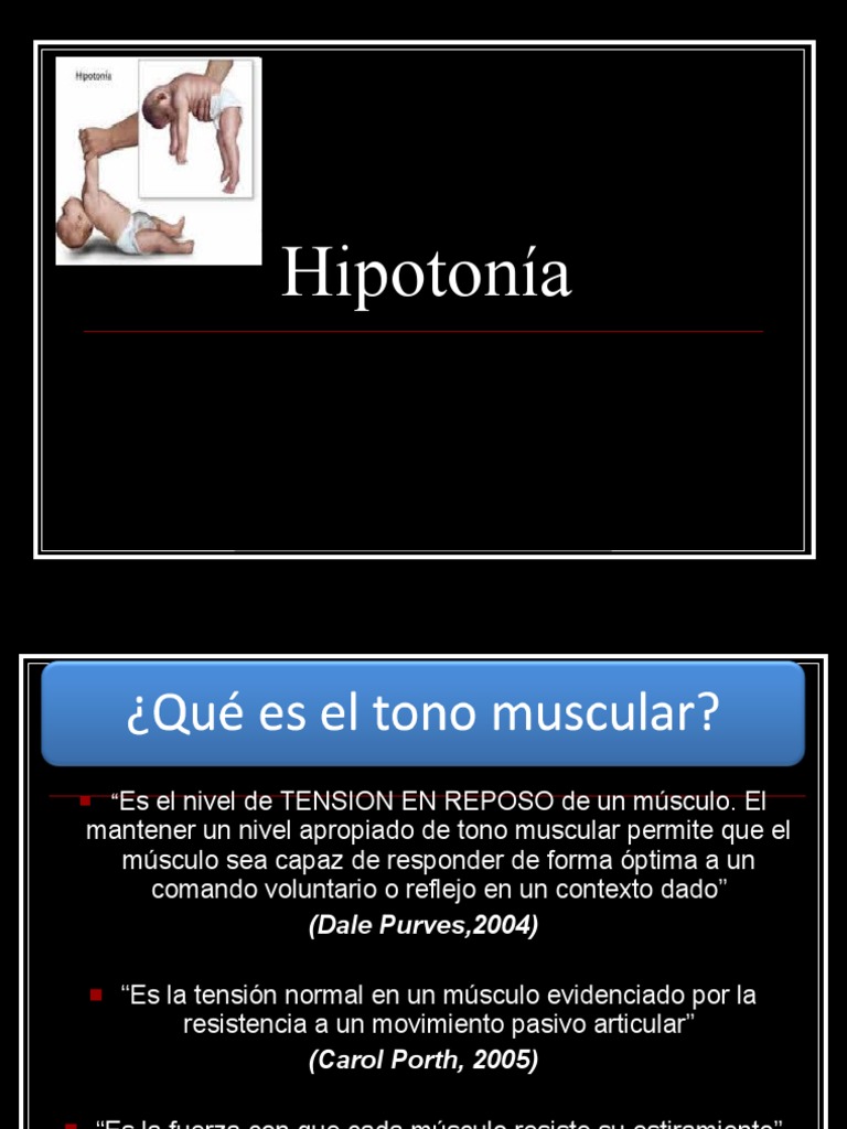 Hipotonía: Evaluación y Tratamiento | PDF | Especialidades Medicas ...