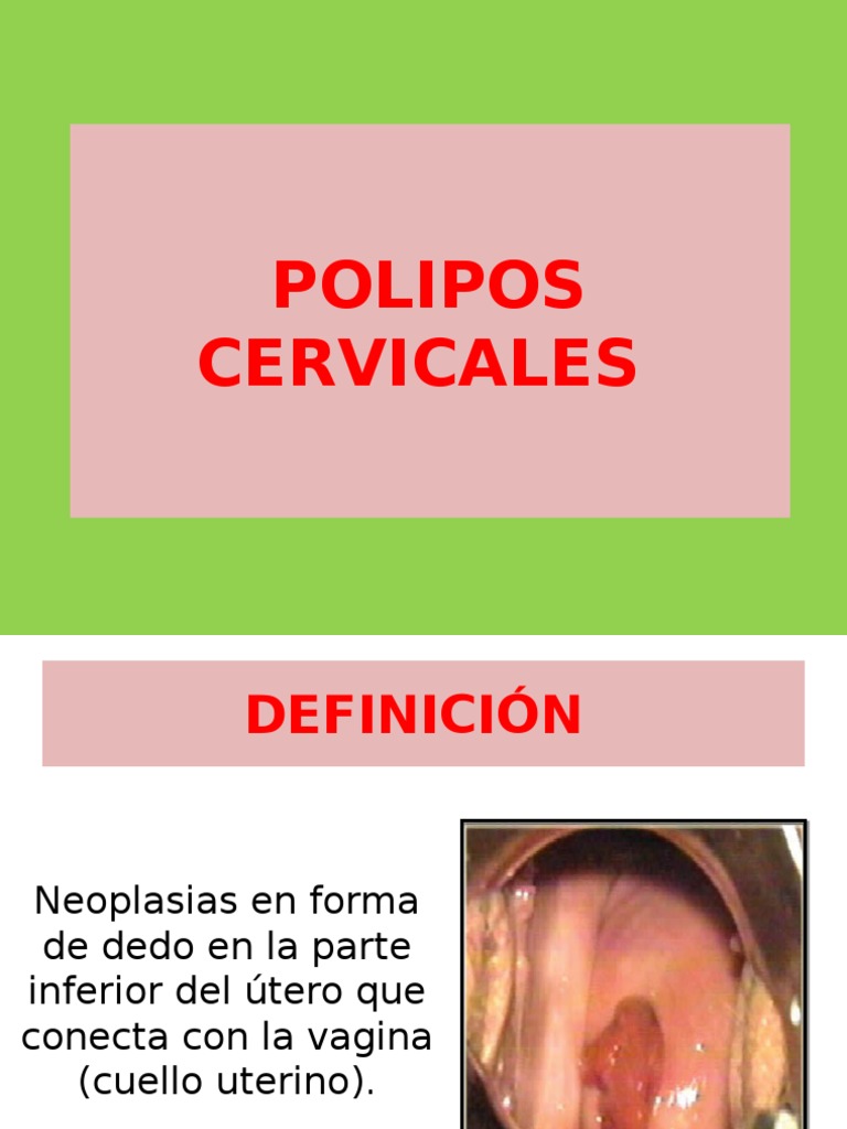 Pólipo Cervical: Causas, Síntomas Y Tratamiento – TRLP