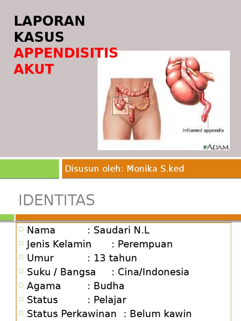 Laporan Kasus Appendisitis Akut | PDF