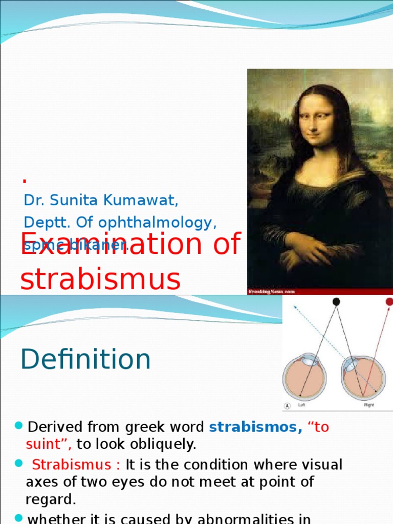 Strabismus Examination and Evaluation Guide | PDF | Visual Acuity ...