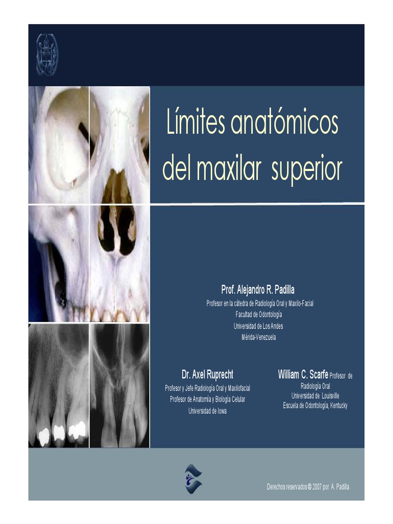 Limites Anatomicos Del Maxilar Superior RX | PDF | Fisonomía | Cabeza y ...